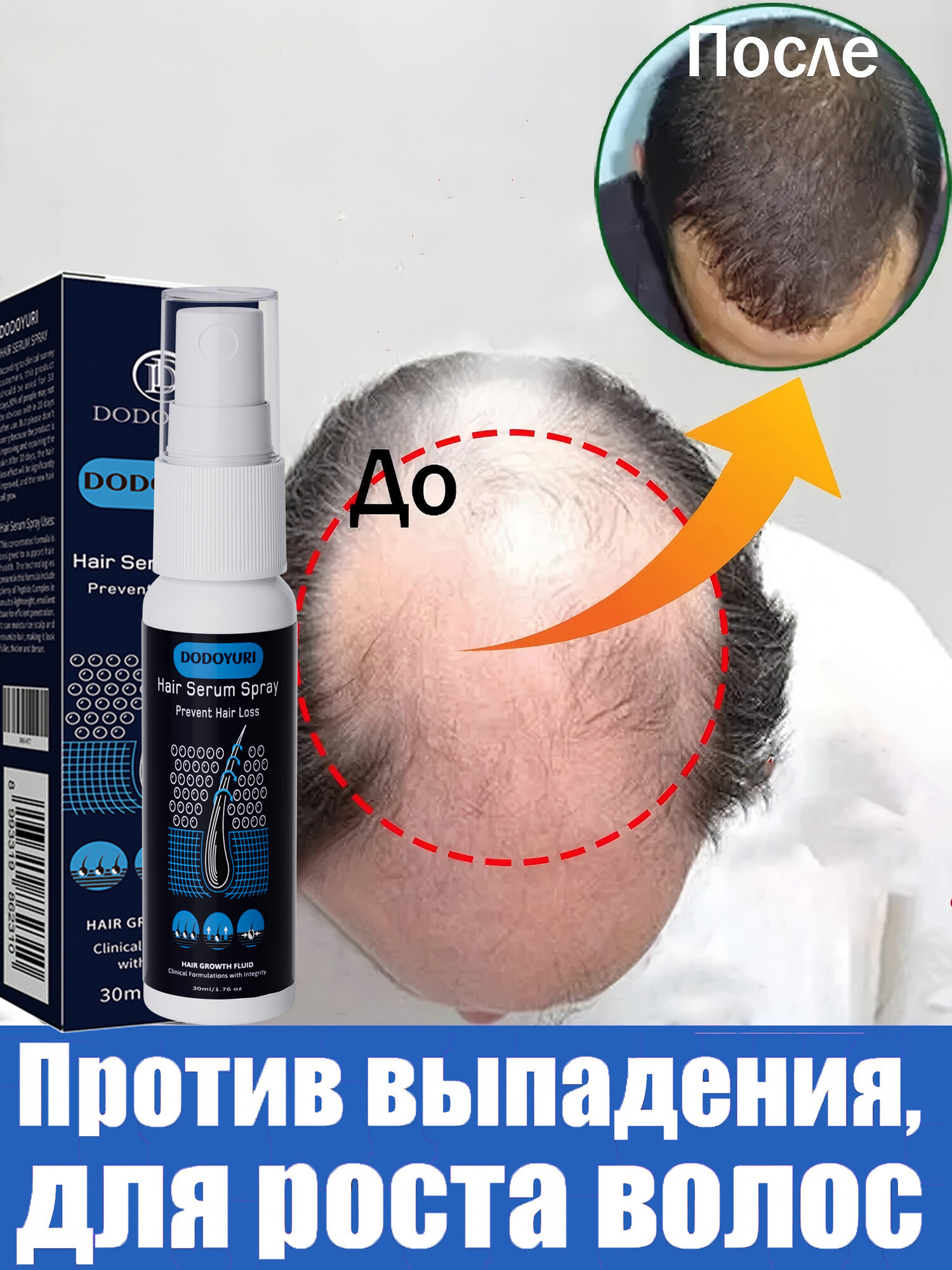 Мощный для роста волос спрей для роста волос, натуральной травяной эссенции, Профессиональное средство от выпадения30мл