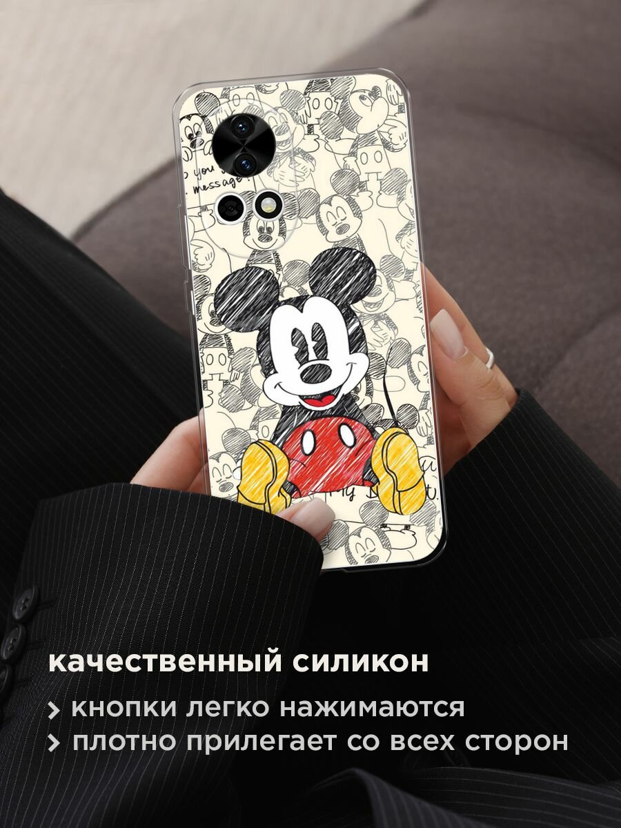 Чехол на Huawei Nova 12/Nova13 / Хуавей Нова 12/Нова 13 с принтом "Микки Маус" — фото 1