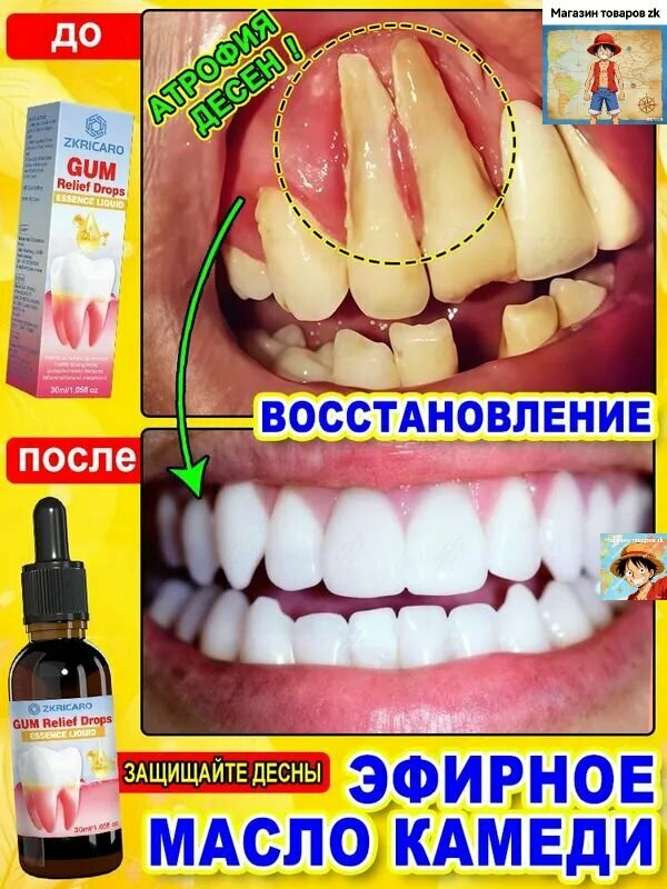 Эфирное масло для ухода за полостью рта на растительной основе, антибактериальное, защищает десны, снимает воспаление, подходит для людей с атрофией десен и чувствительными зубами.30 мл на флакон