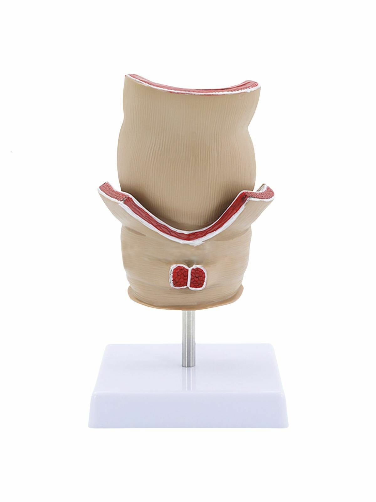 1 набор моделей патологии прямой кишки