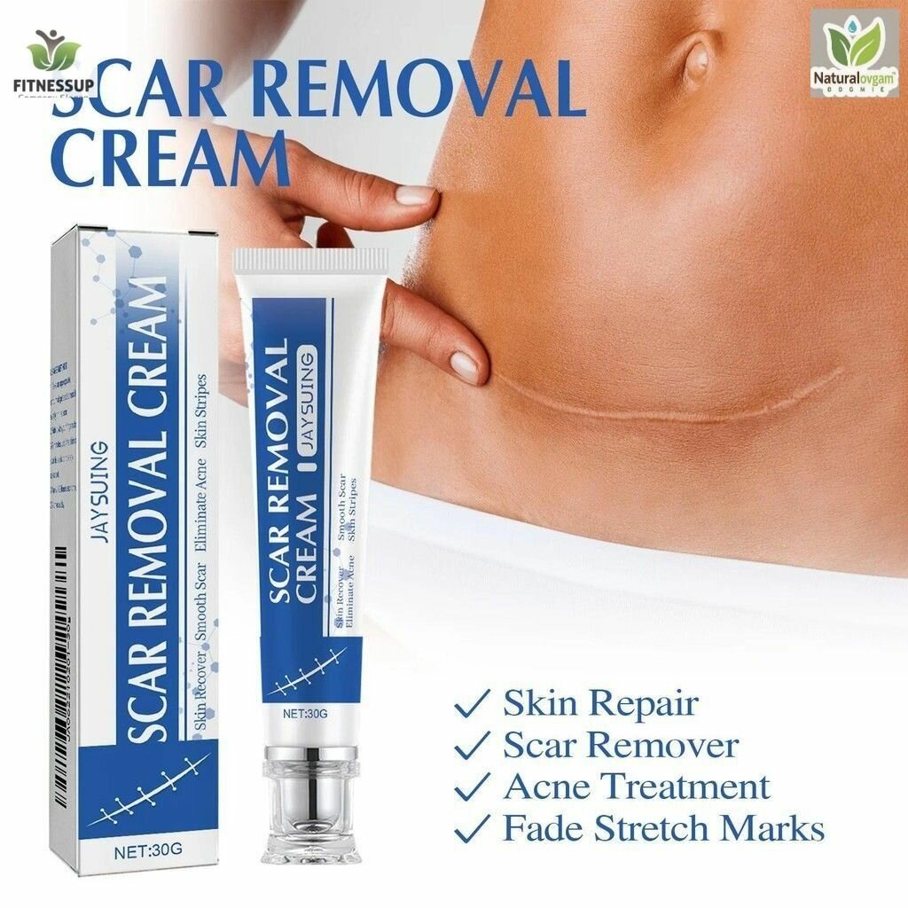 Крем от шрамов и растяжек Fast Scar выравнивание кожи, удаление рубцов CO712