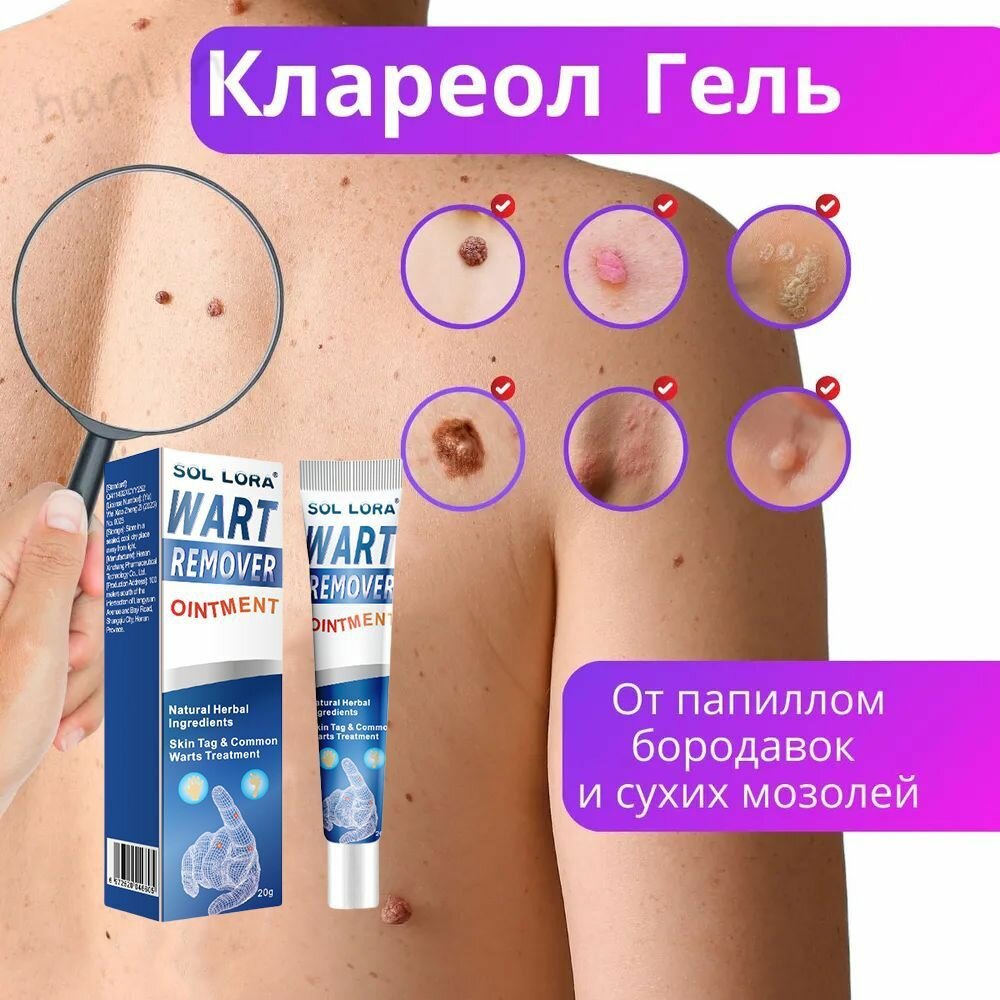 Средство от папиллом и бородавок, мазь для ухода за кожей, крем от родинок, Натуральные растительные ингредиенты