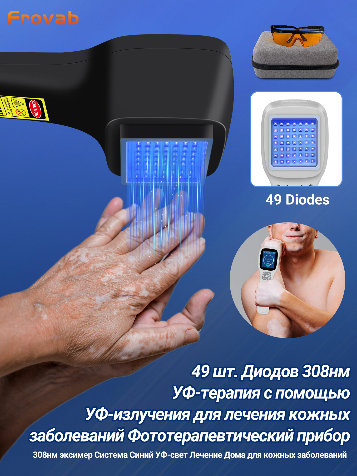 УФ-терапия Frovab 308нм 49 диода, доза 0-5 Дж/см², лечение псориаза, витилиго, дерматита и акне у взрослых