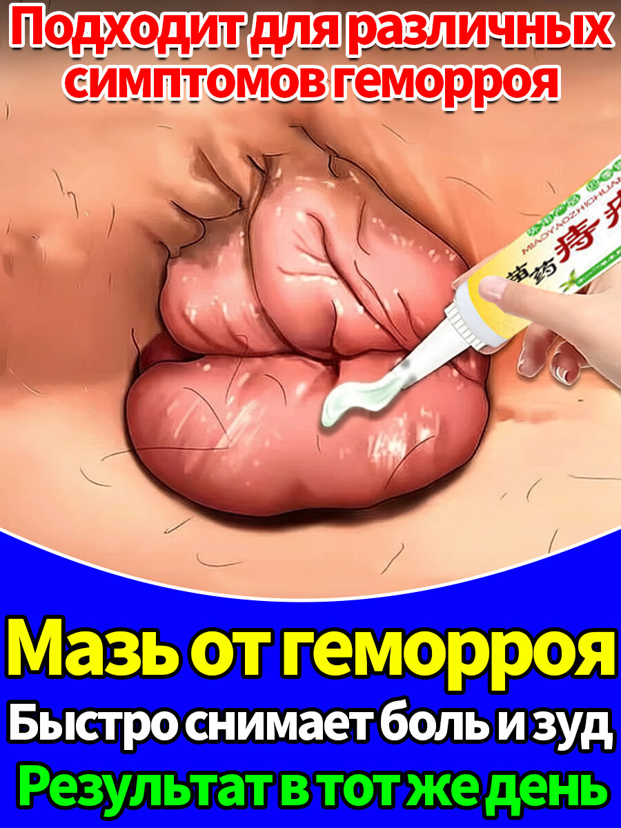 Китайская чудо мазь от геморроя, 100% натуральная, лечит геморрой и анальные трещины, снимает боль, уменьшает отек и дискомфорт, как для мужчин, так и для женщин, 20 г.