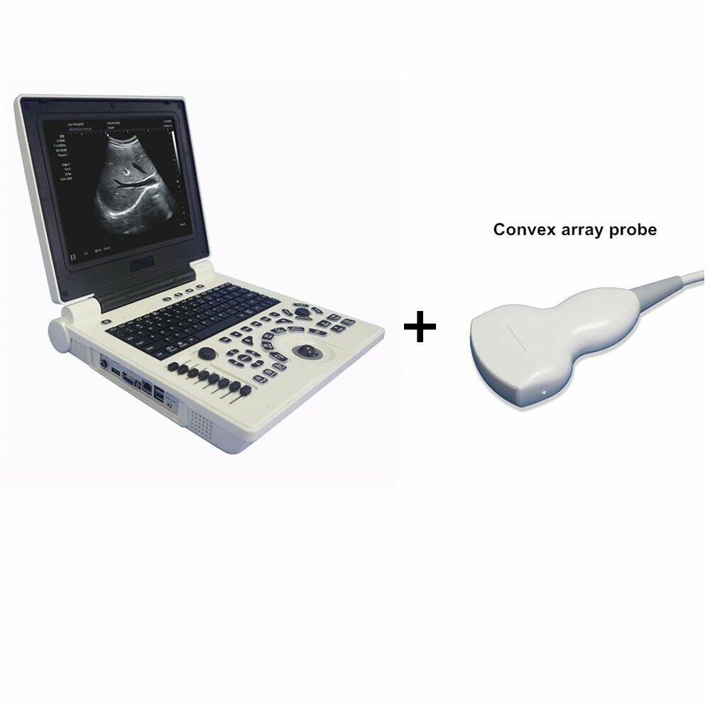 NESWELLMED Портативный УЗИ сканер с convex array probe