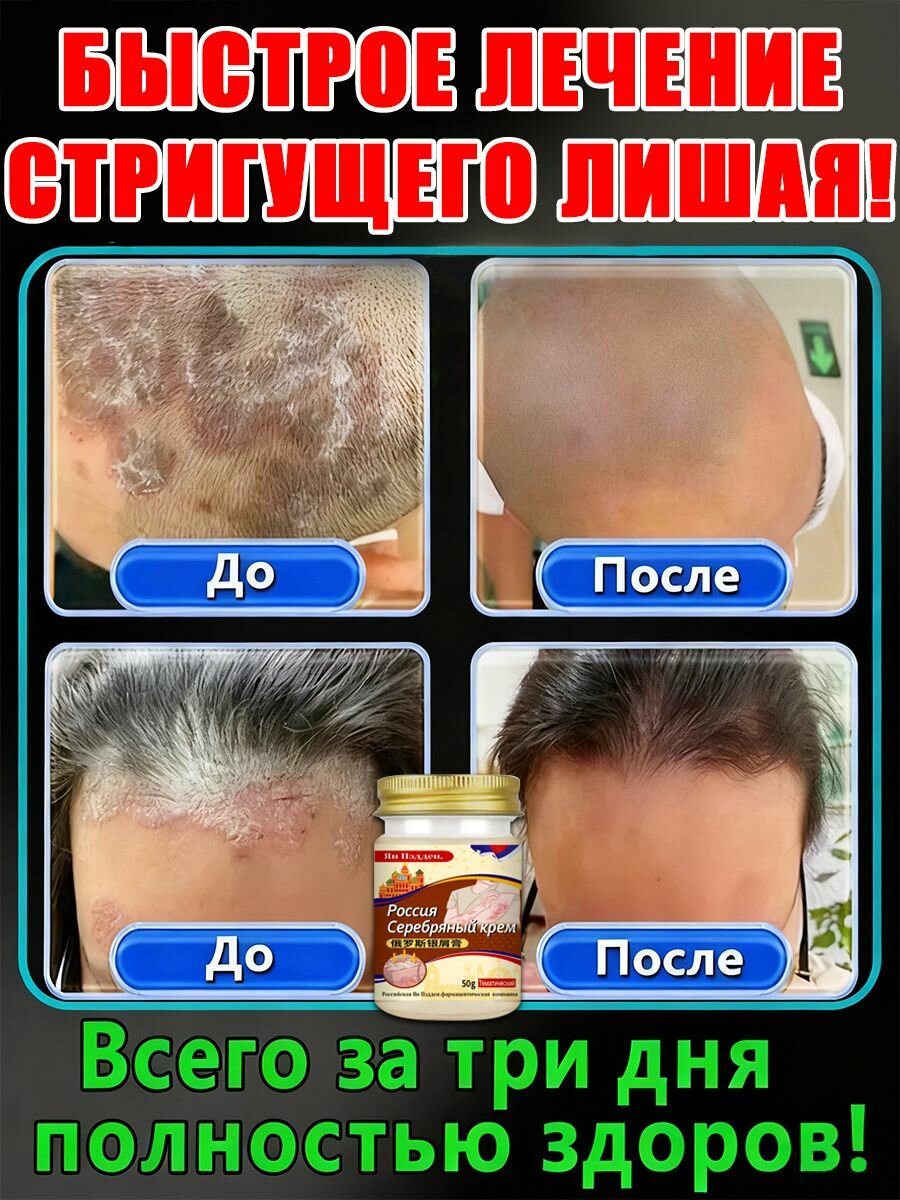 Мазь от псориаза китайская Антипсориаз крем негормональный от дерматита и экземы снимает зуд покраснение и раздражение 50 г