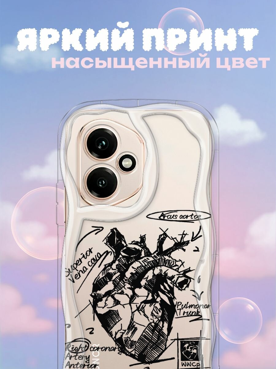 Чехол на Honor 400 / Хонор 400 с принтом "Анатомическое сердце 2" — фото 1