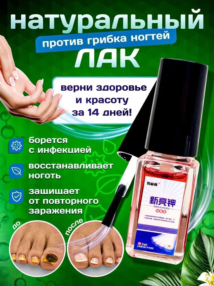 Средство от грибка ногтей на ногах и руках, масло от грибка ногтей на ногах Xinliangjia, 5 ml