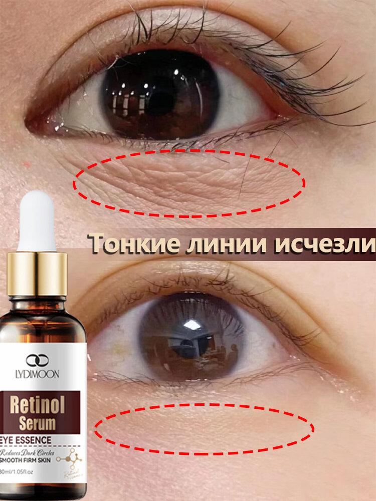 Сыворотка для кожи вокруг глаз с ретинолом 30 мл Осветляет мелкие морщинки вокруг глаз и «гусиные лапки»