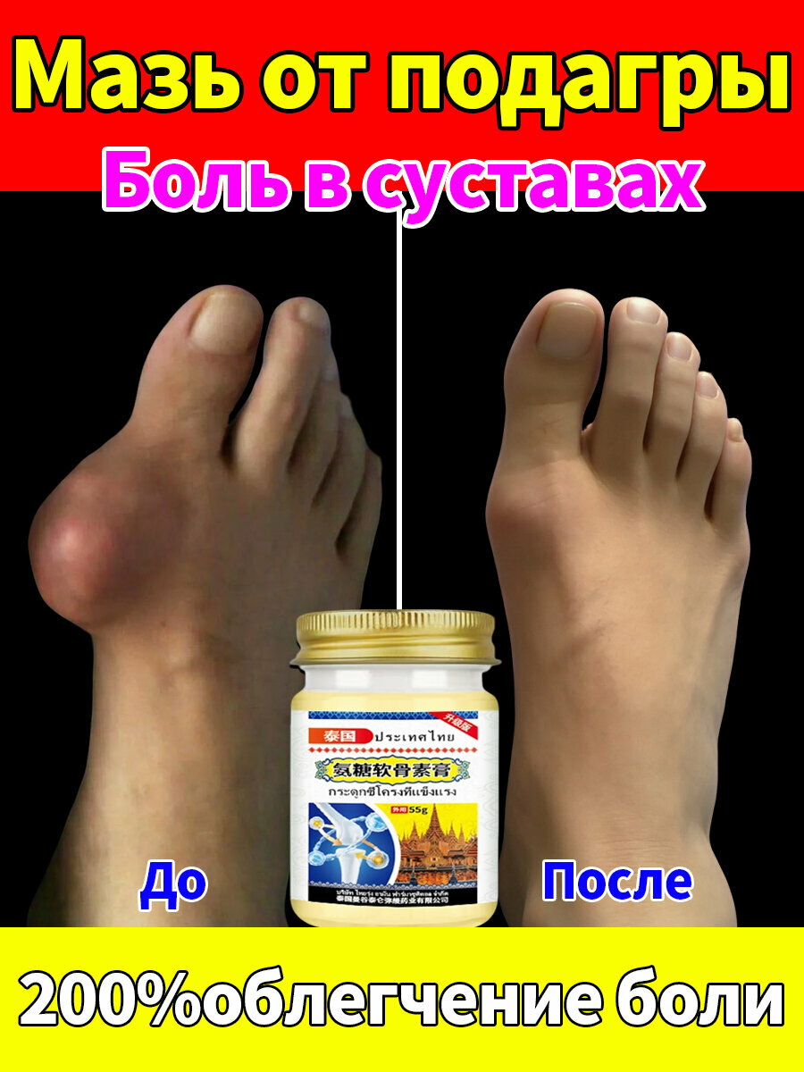 Мазь от подагры, Устранение боли при артрите, коленях, пальцах ног и т. д, на ноге и для рук и артрита 55 г