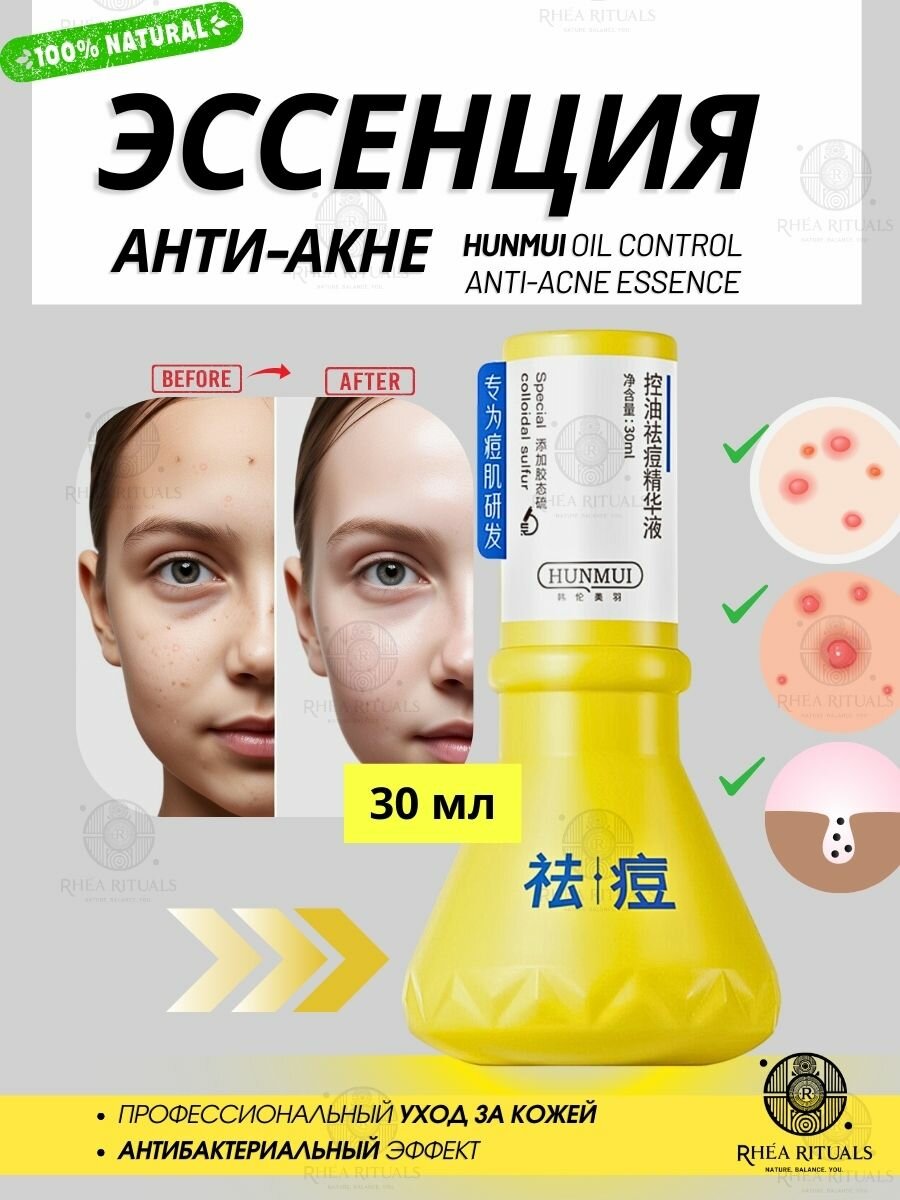 Сыворотка от прыщей и акне HUNMUI Oil Control с коллоидной серой и портулаком для проблемной кожи, 30 мл