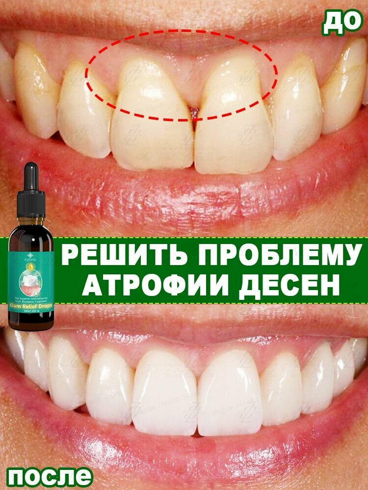 Используется для лечения пародонтита, стоматита, снятия чувствительности и отека десен, восстановления, профилактики и укрепления поврежденных десен, Гигиена полости рта, 30 мл, 1 флакон