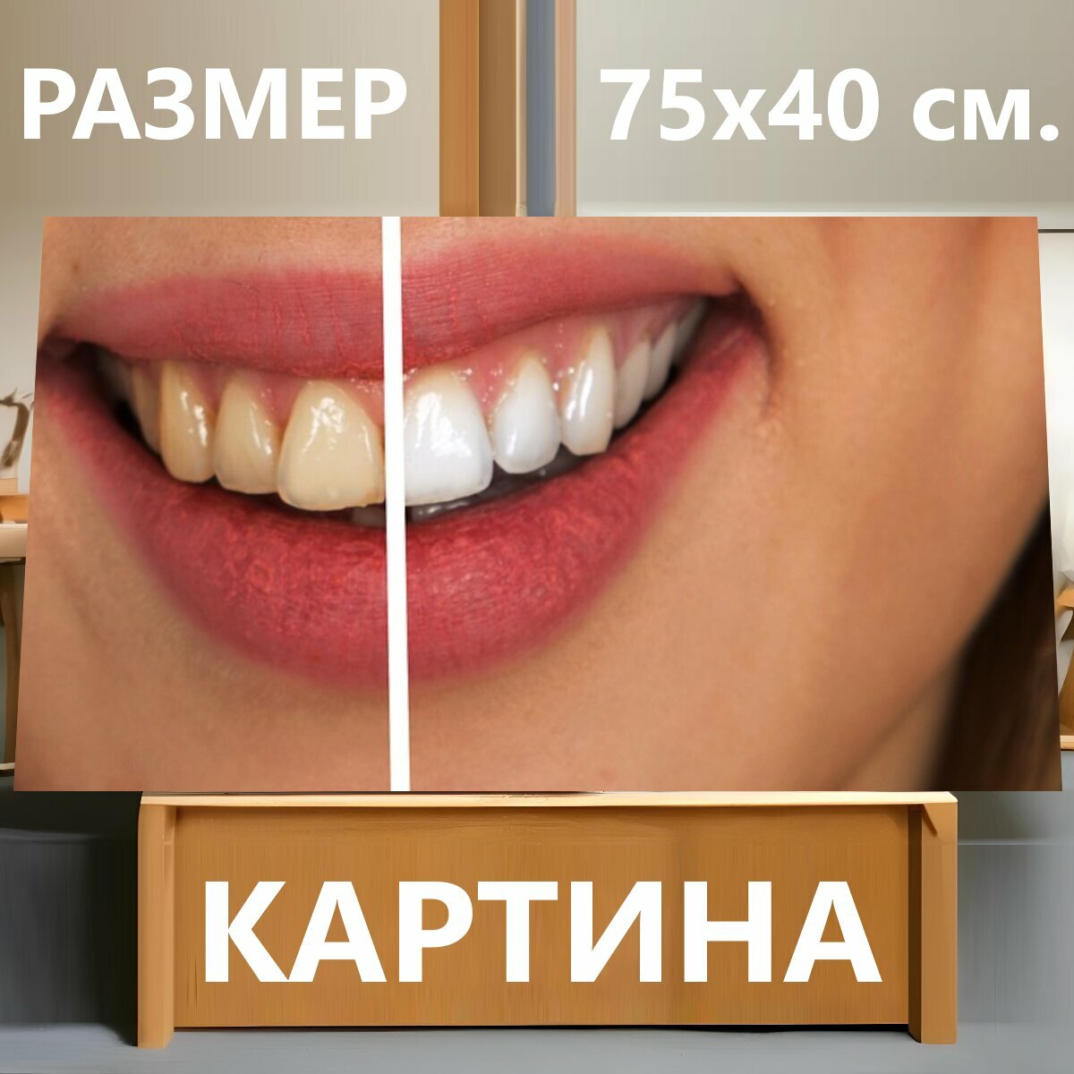 Картина на холсте "Зубы, стоматологическая помощь, белый" на подрамнике 75х40 см. для интерьера