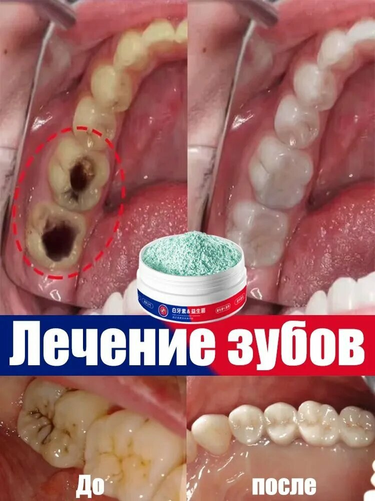 Зубной порошок