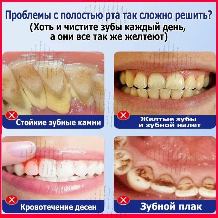 Зубная паста