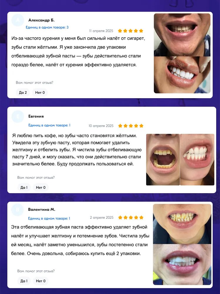 Зубная паста — фото 1