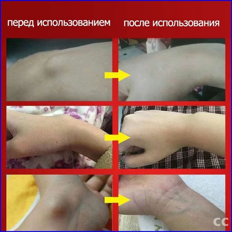 Лечебное средство — фото 1