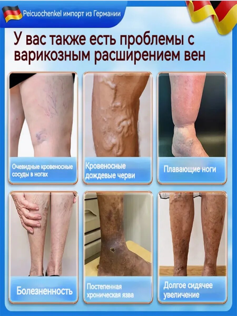 Чудо бальзам дымок китайский от варикоза 50 г