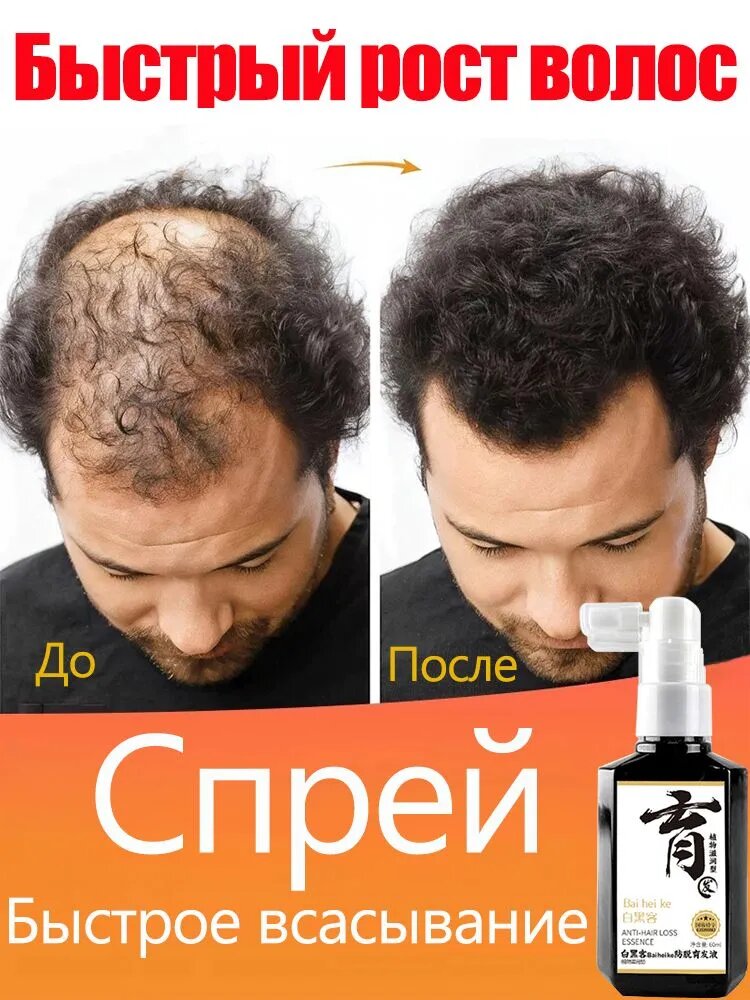 Профессиональное средство от выпадения, восстановление корней, активатор роста, увеличение густоты/ против облысения, Средство от выпадения волос у мужчин и женщин, 60 мл.