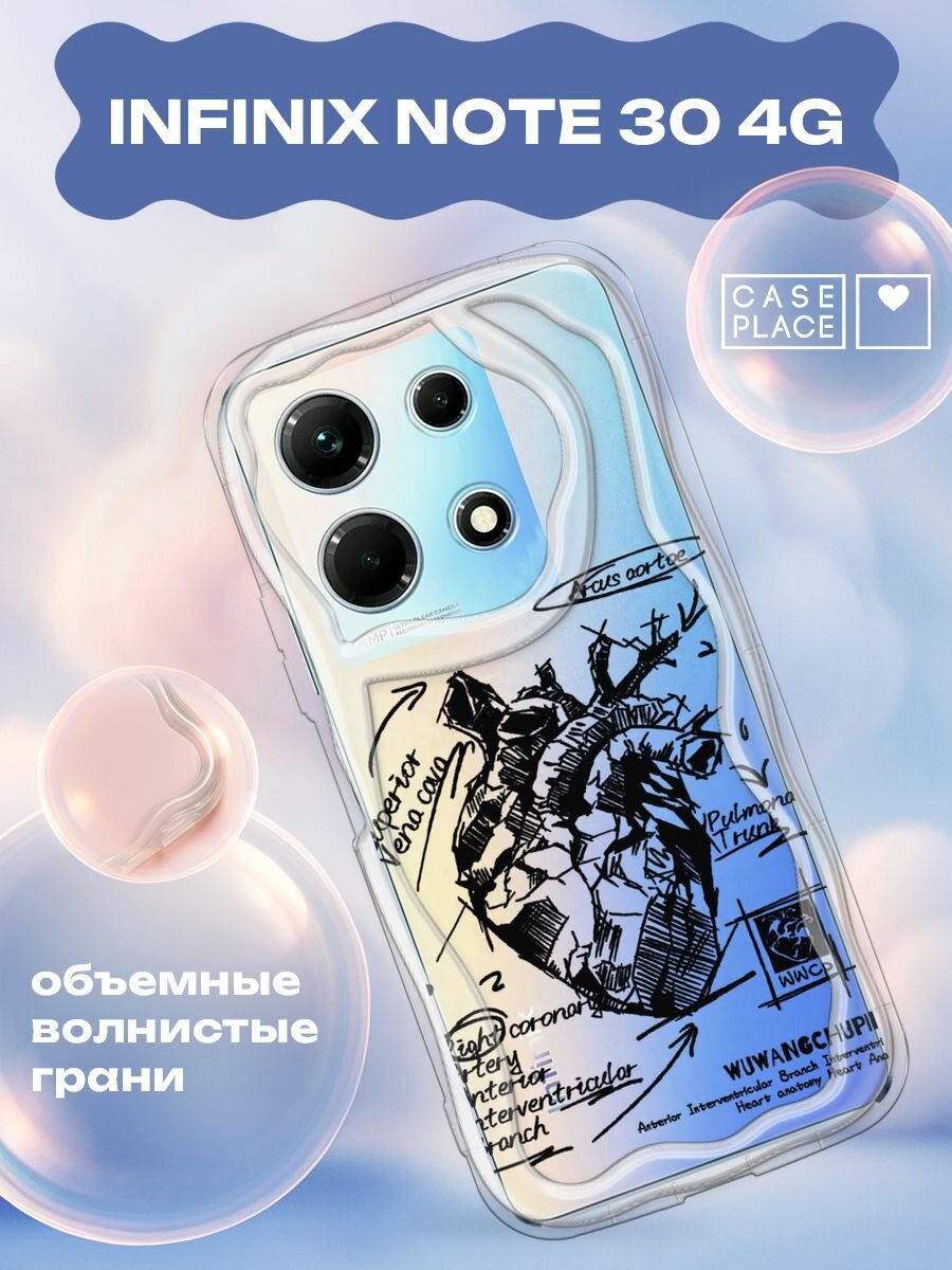 Чехол на Infinix Note 30 4G / Инфиникс Ноте 30 4G с принтом "Анатомическое сердце 2"