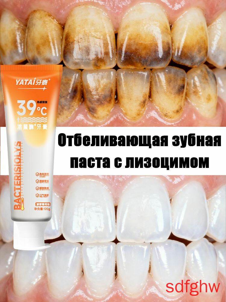 Отбеливающая зубная паста с лизоцимом устраняет желтизну и неприятный запах изо рта 120 г