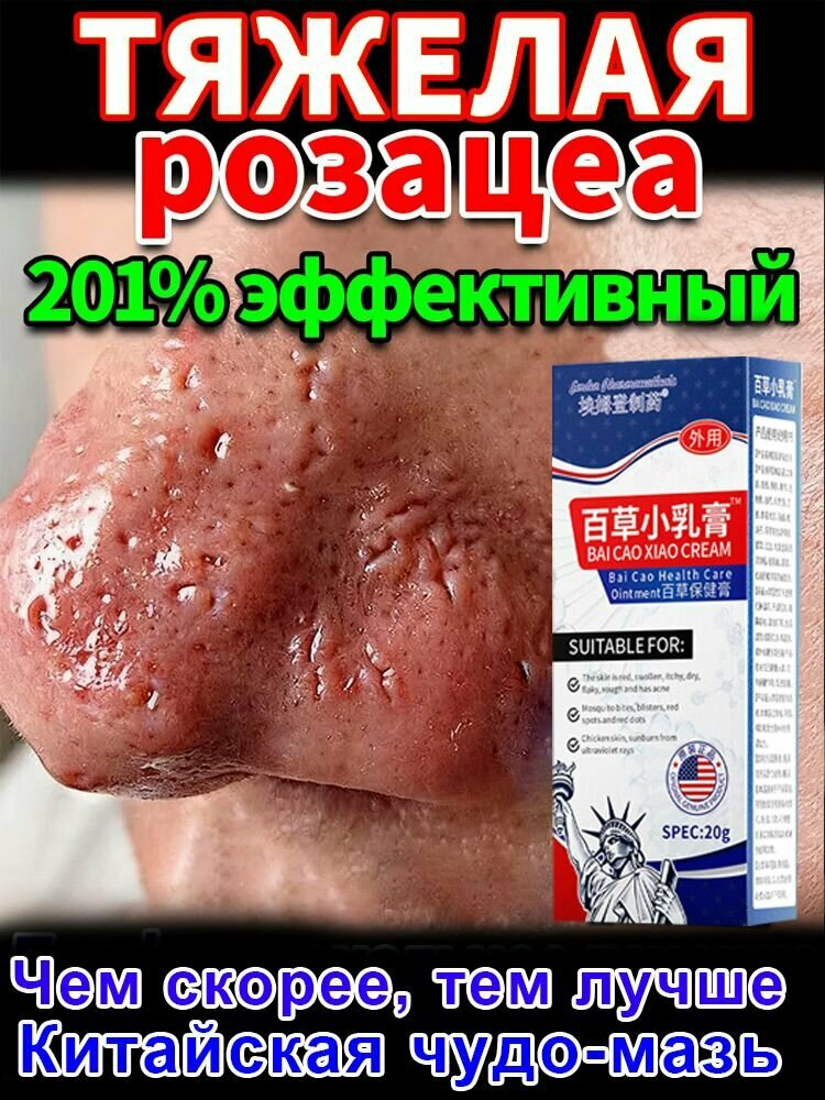 Крем от розацеа на лице 20 мл