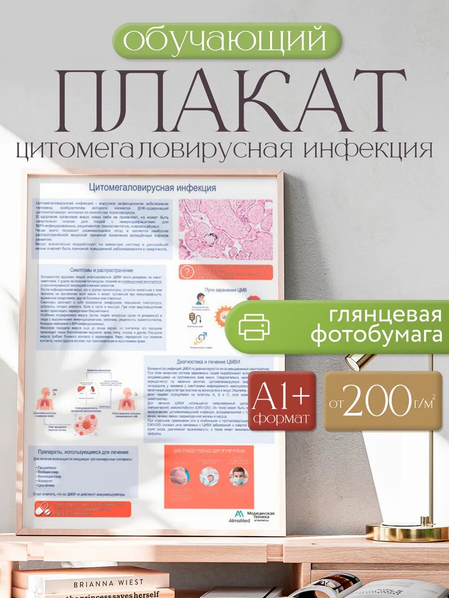 Цитомегаловирусная инфекция, медицинский плакат, глянцевая фотобумага от 200 г/кв. м, размер A1+