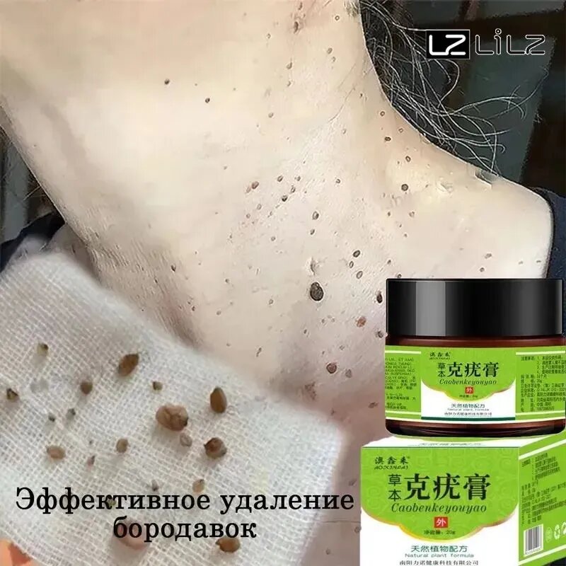Лечебное средство для удаления бородавок, крем Caobenkeyouyao, 20 г, для всех типов кожи