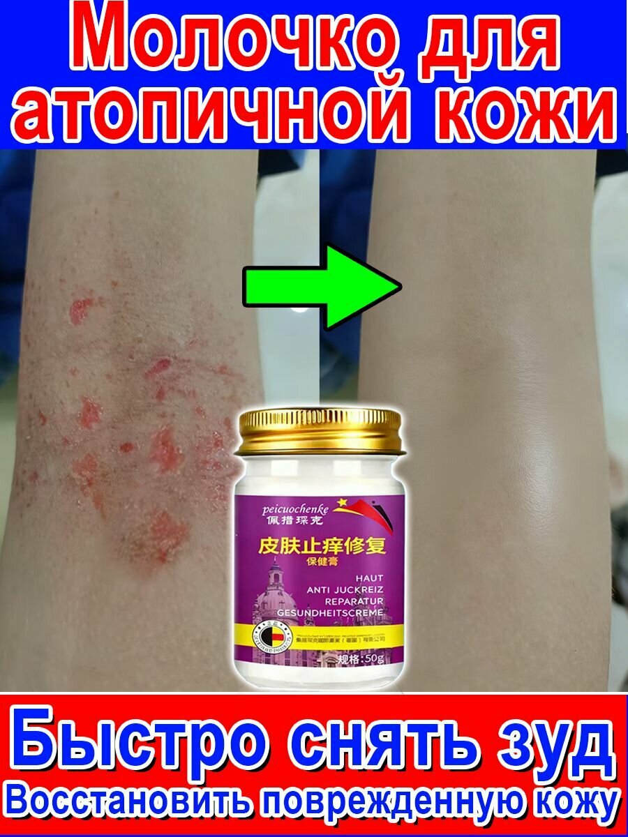 Лосьон для атопичной кожи детский