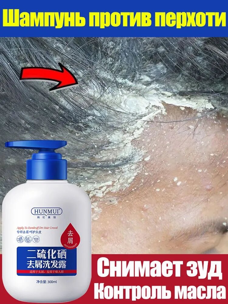 Шампунь с сульфидом селена, Интенсивный против перхоти, зуда и себореи для нормальных и жирных волос, восстанавливающий уход для волос, 300 мл