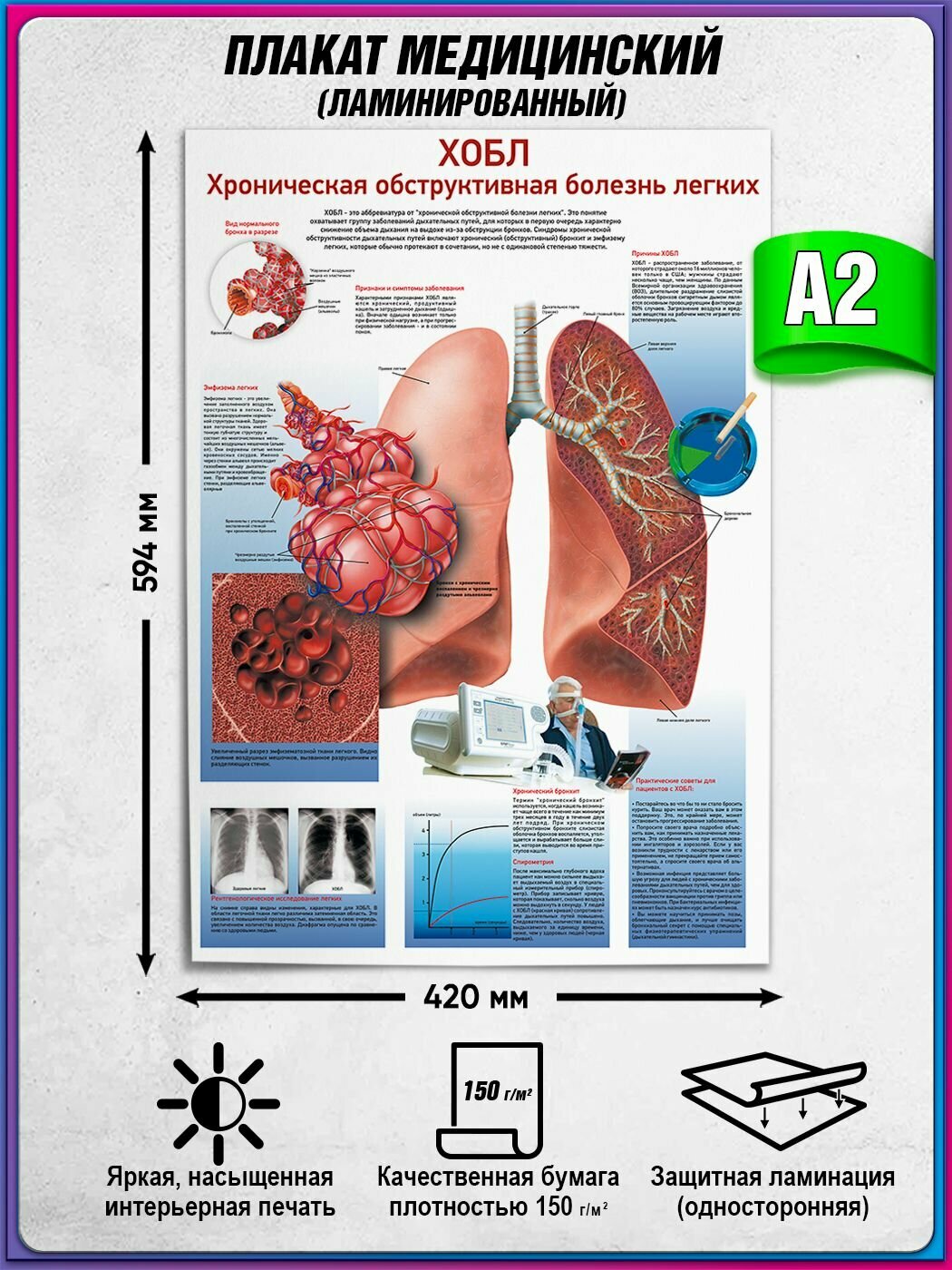 Информационный медицинский плакат "Хобл: Хроническая обструктивная болезнь легких" / ламинированный / А-2 (42x60 см.)
