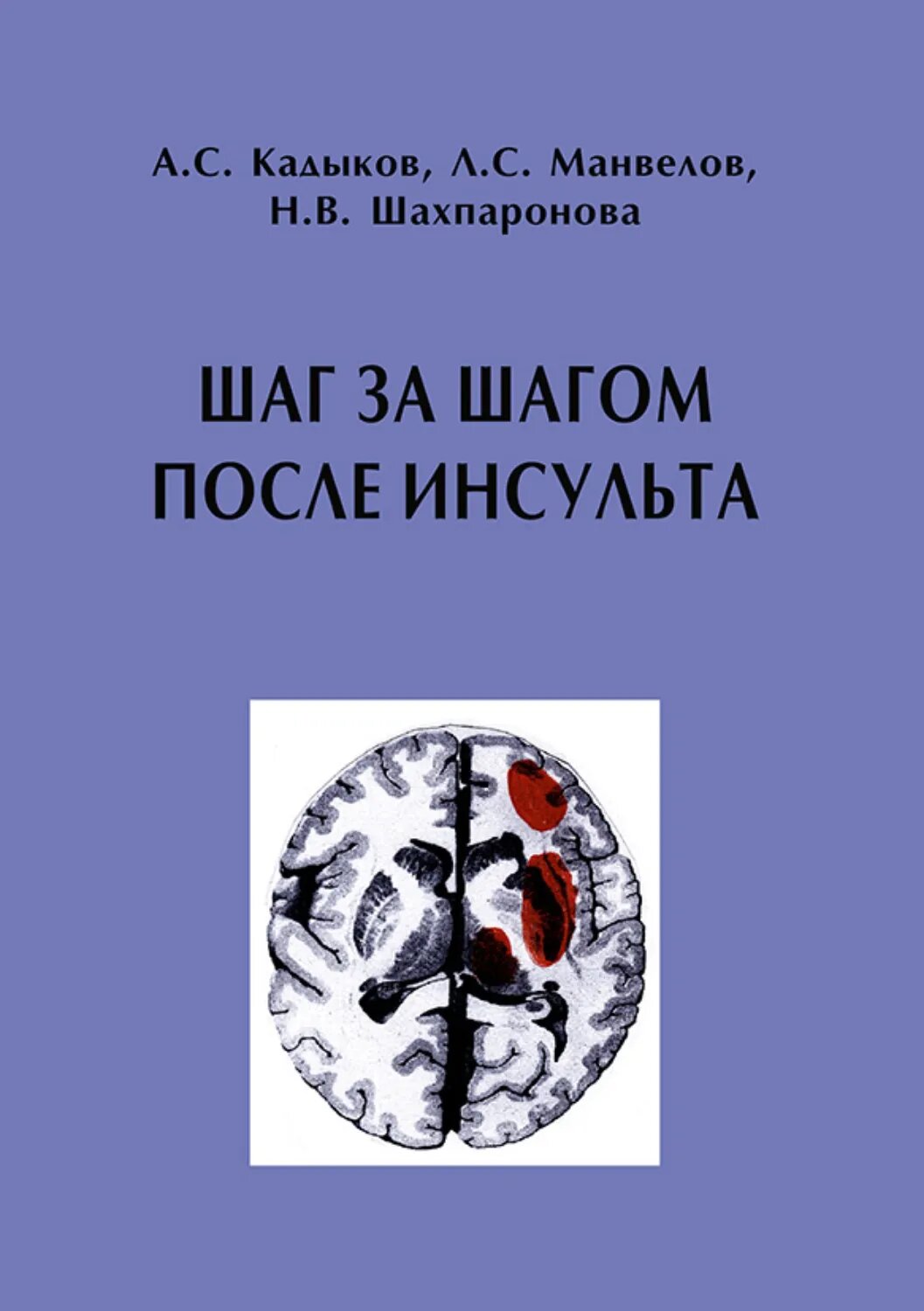 Шаг за шагом после инсульта: Пособие для пациентов и их родственников [Цифровая книга]