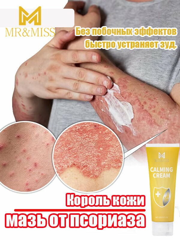 Крем от псориаза MR&MISS, мазь от псориаза, атопического дерматита и нейродермита, 20 мл