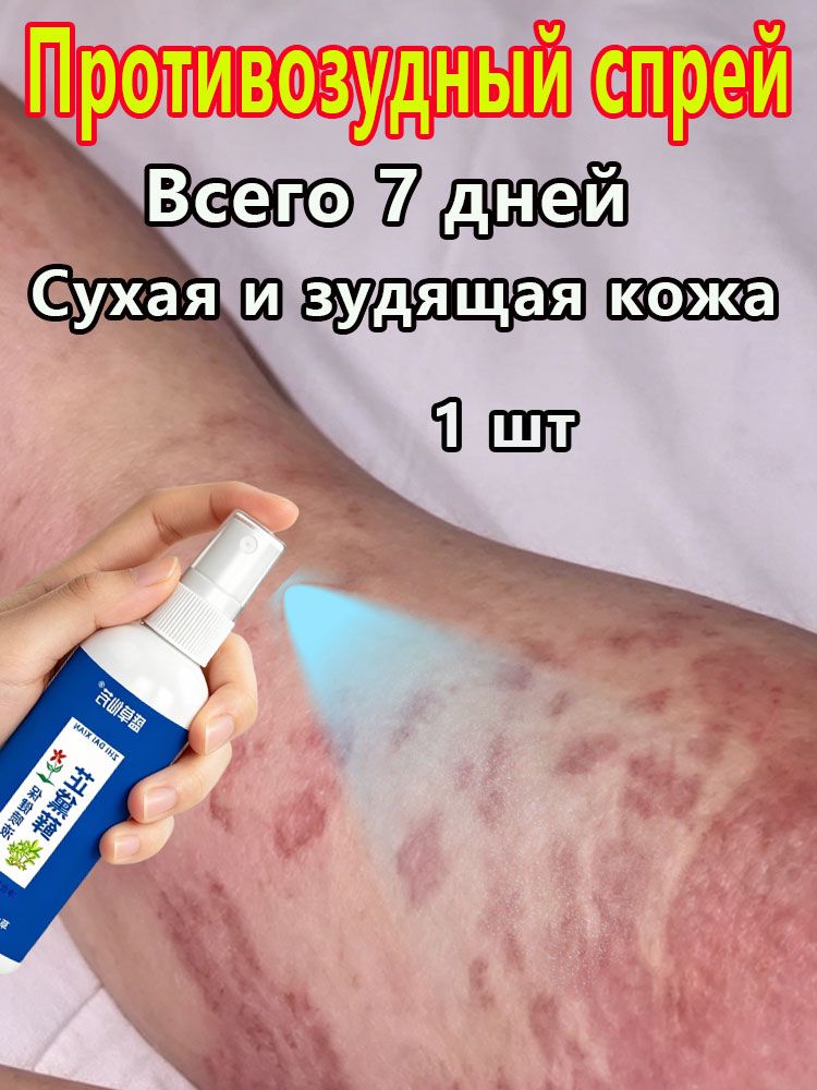 Спрей против зуда, при грибковом зуде кожи, герпесе, экземе, дерматите, против зуда, 100 мл