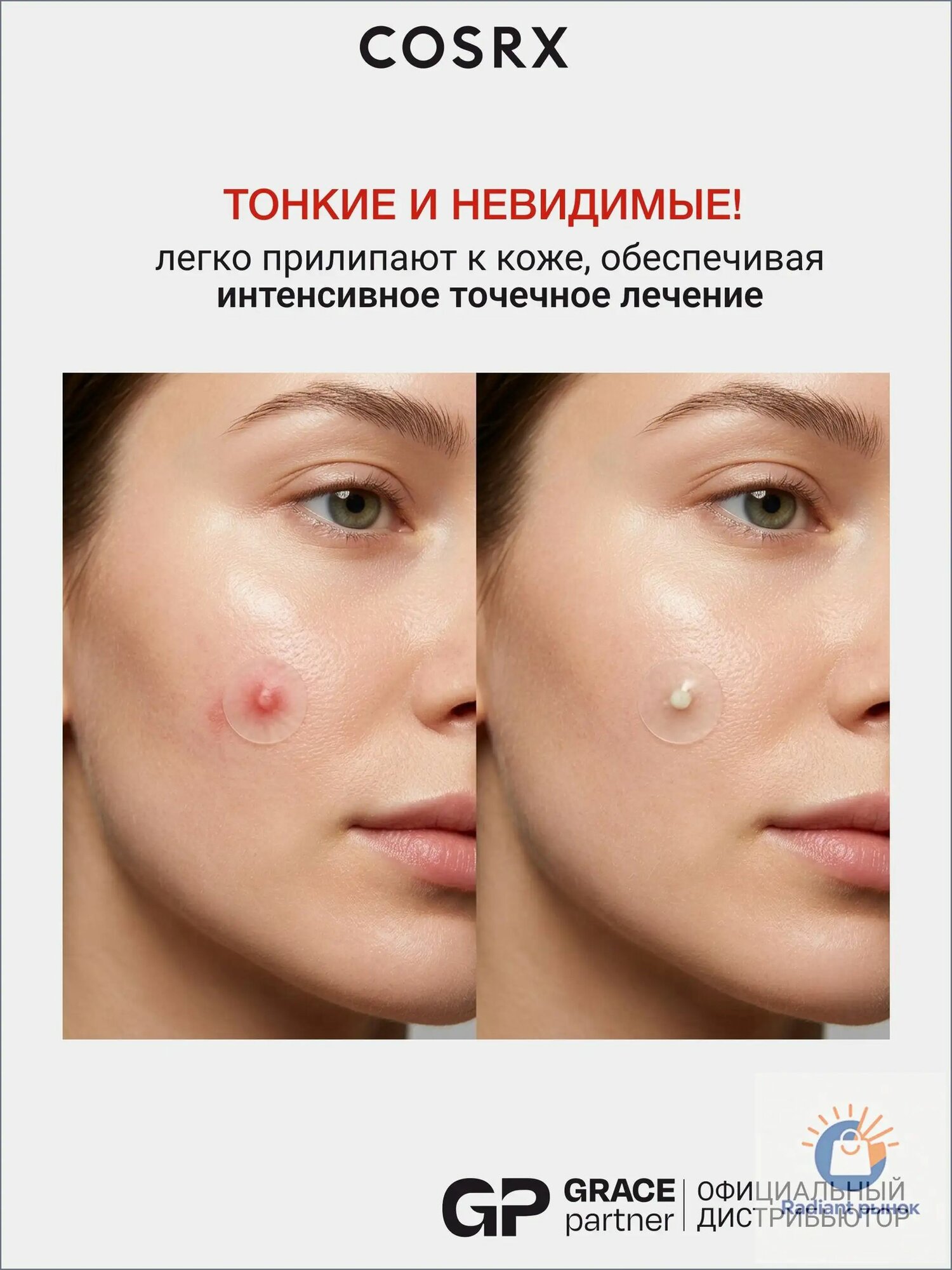 Патчи от акне COSRX Acne Pimple Master Patch — фото 1