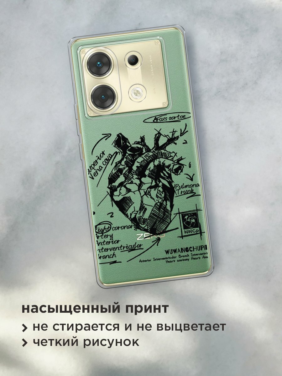 Чехол на Infinix Zero 30 5G / Инфиникс Зеро 30 5G с принтом "Анатомическое сердце 2", прозрачный — фото 1