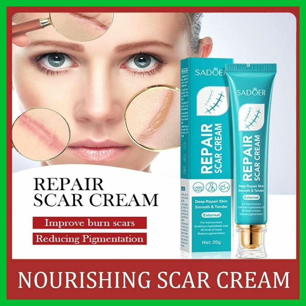 Крем-гель от шрамов, рубцов, растяжек, травм и пигментации, мазь от следов прыщей для лица и тела