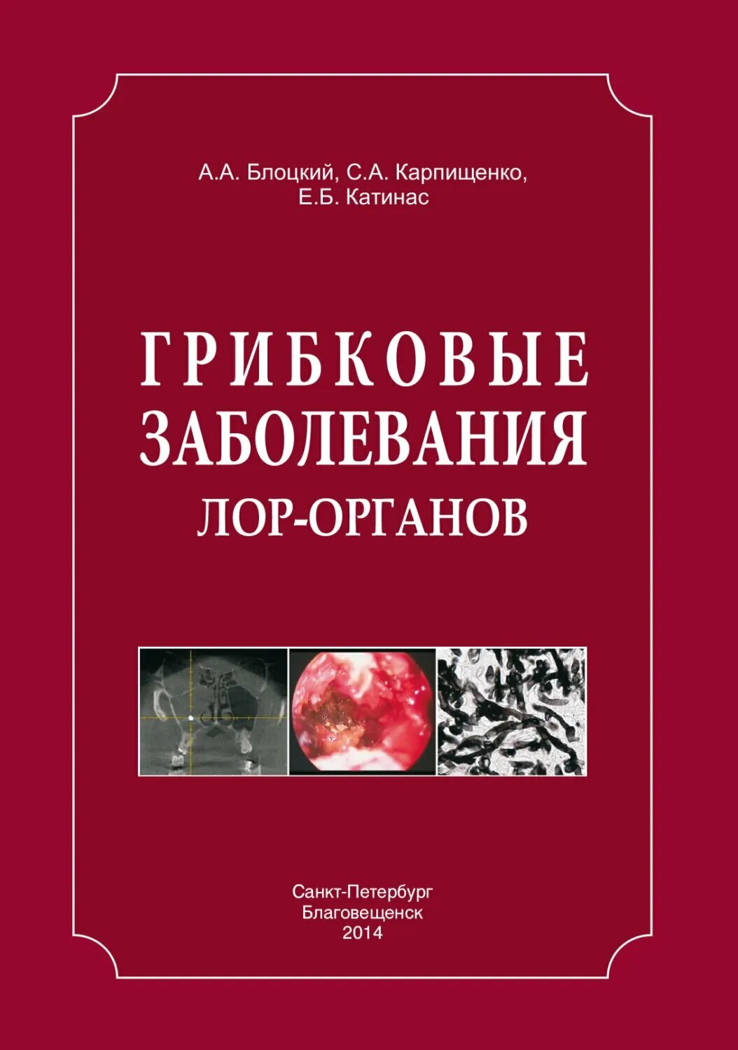 Грибковые заболевания ЛОР-органов [Цифровая книга]
