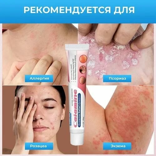 Крем для ухода за кожей при псориазе, экземе и герпесе, акне, ожогах, порезах,20 г
