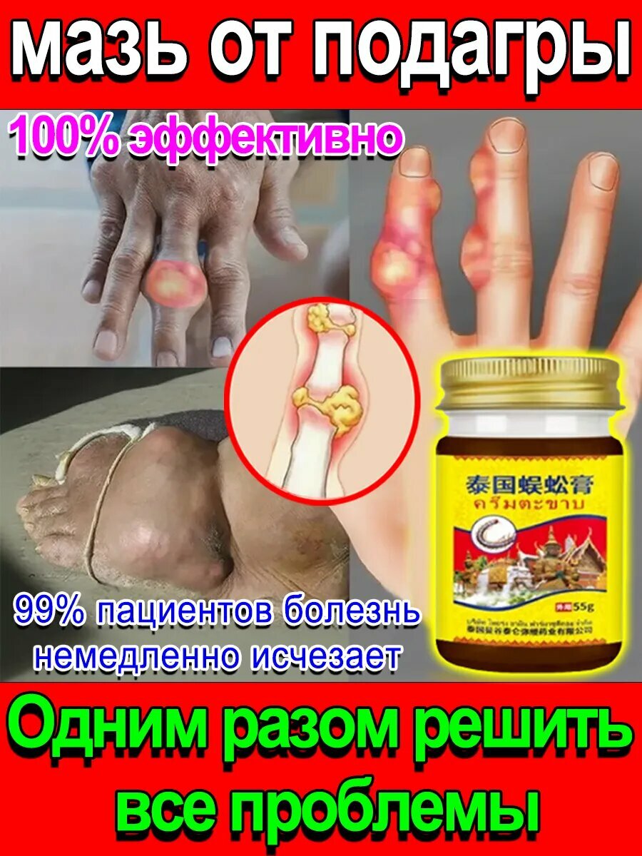 Мазь от подагры на ноге и для рук и артрита