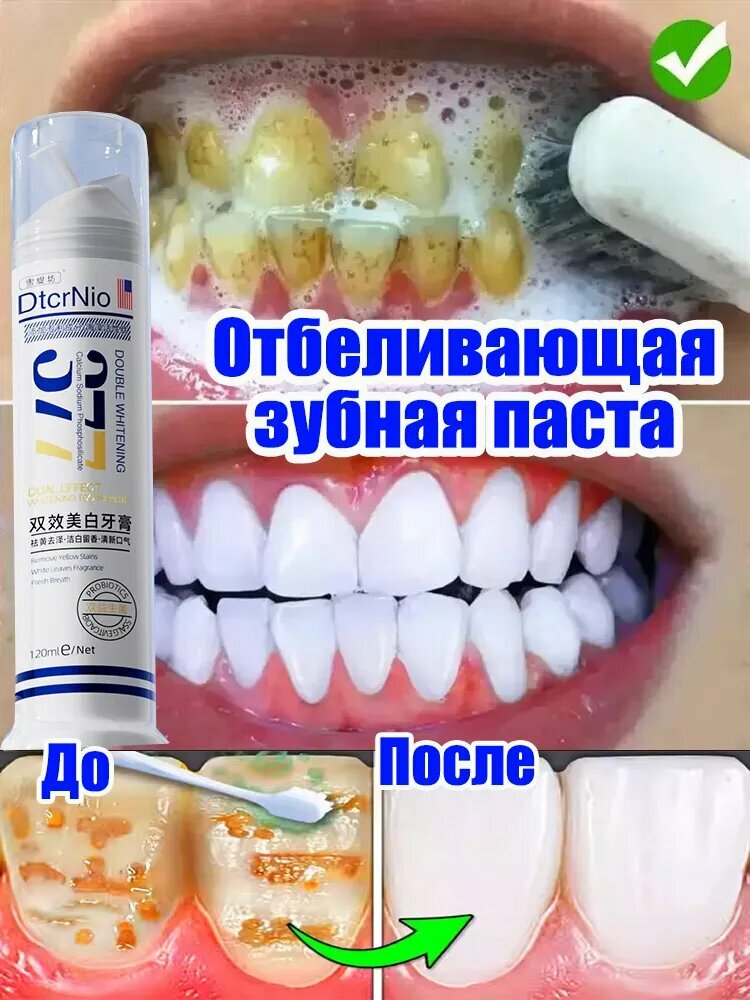 Отбеливающая зубная паста120 г, удаляет пожелтение зубов и запах изо рта, против зубного камня и налета от кофе и сигарет, от кариеса, укрепление эмали