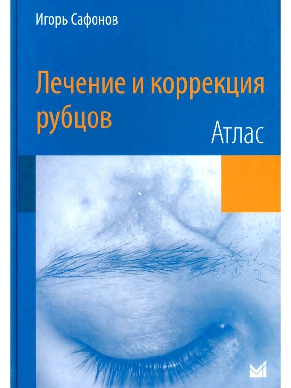 Лечение и коррекция рубцов. Атлас (Сафонов И.)