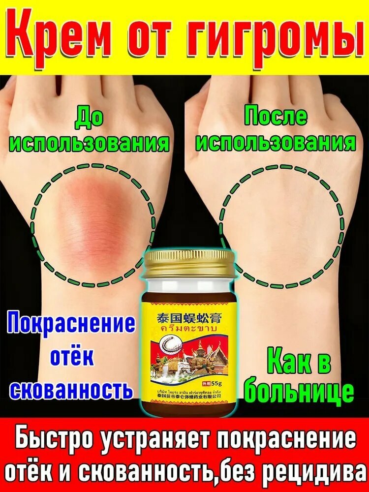 Быстрое облегчение при гигроме и тендините, 55 г. Крем помогает снять боль и отек.