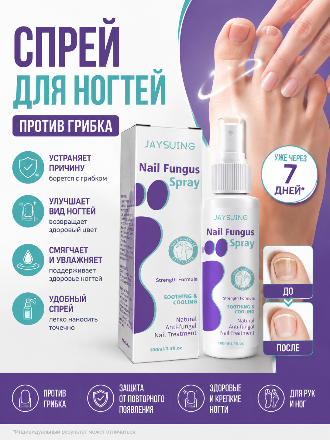 Спрей для ухода за ногтями: способствует уходу за мягкими ногтями, предотвращает пожелтение и утолщение ногтей