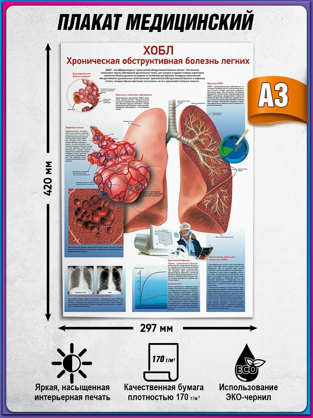 Информационный медицинский плакат "Хобл: Хроническая обструктивная болезнь легких" / А-3 (30x42 см.)