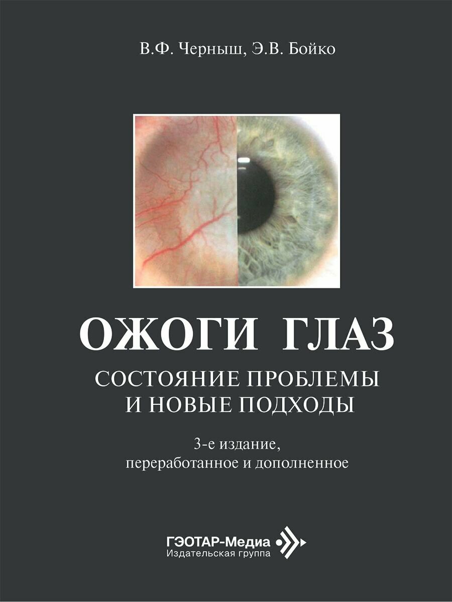 Ожоги глаз. Состояние проблемы и новые подходы