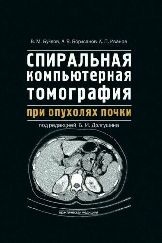 Спиральная компьютерная томография при опухолях почки. Буйлов