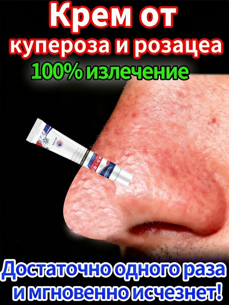 Крем для лечения розацеа и купероза, снимает покраснение и раздражение кожи, уменьшает проявление сосудов, 20 г.
