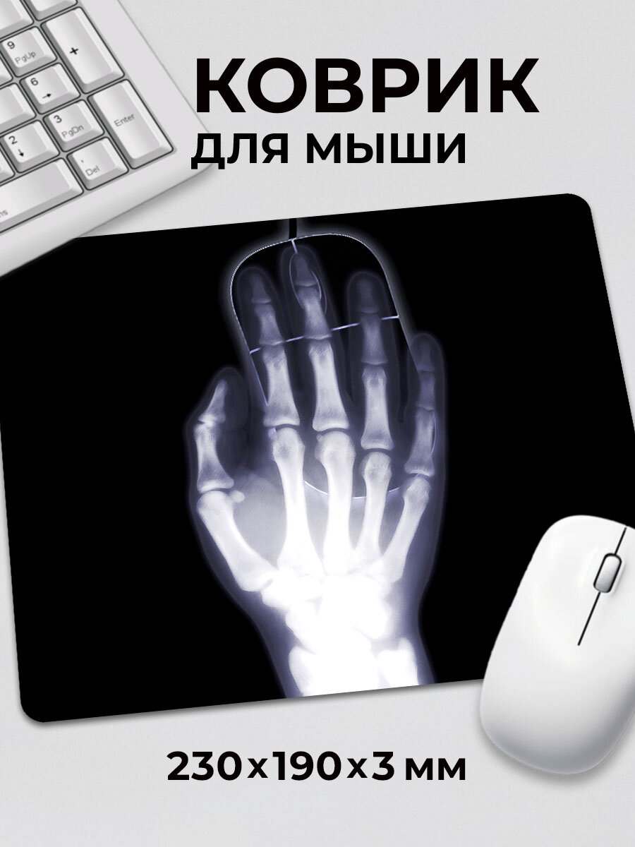 Коврик для мышки чёрный Рентген Рука с компьютерной мышкой В рентгеновский кабинет, КТ или МРТ