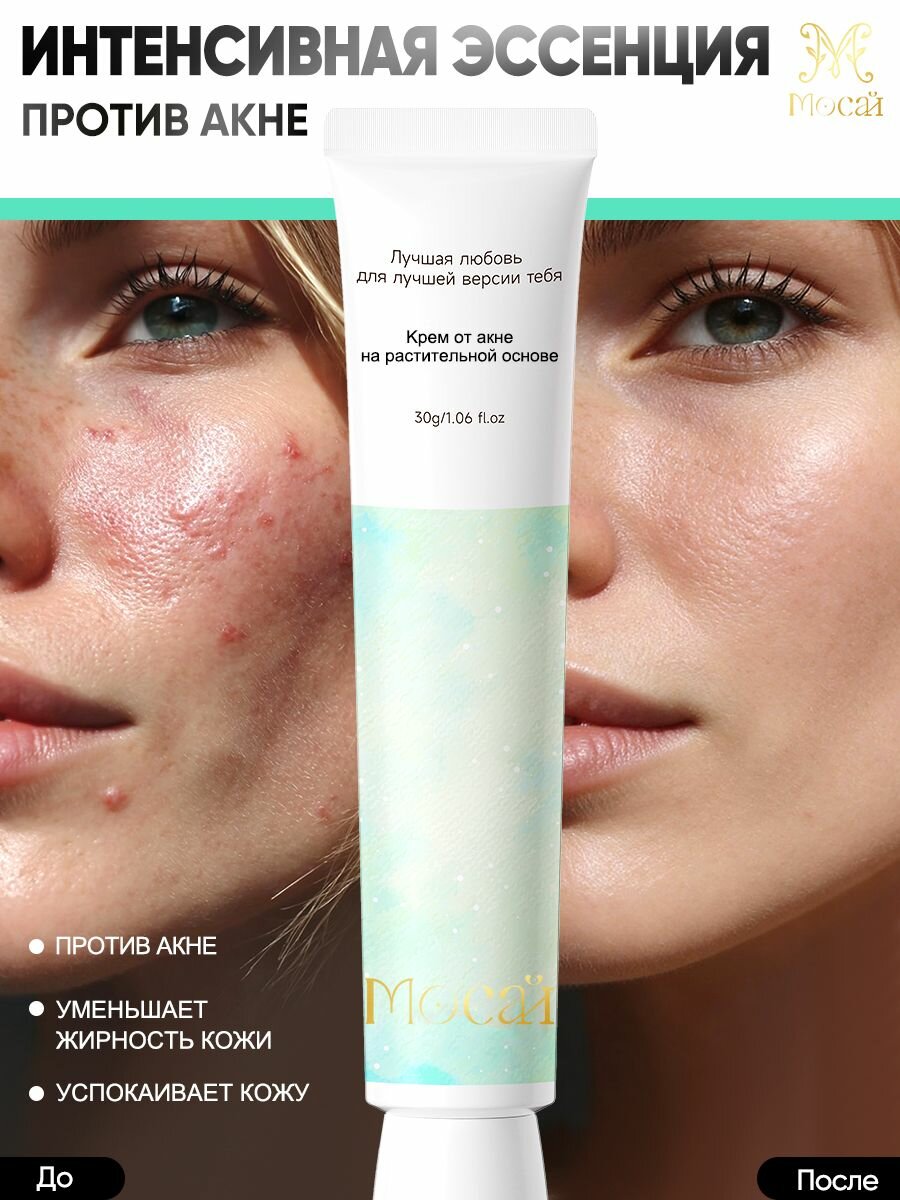 Точечный крем от прыщей с экстрактом агримонии, контроль себума, против воспалений, 30 мл